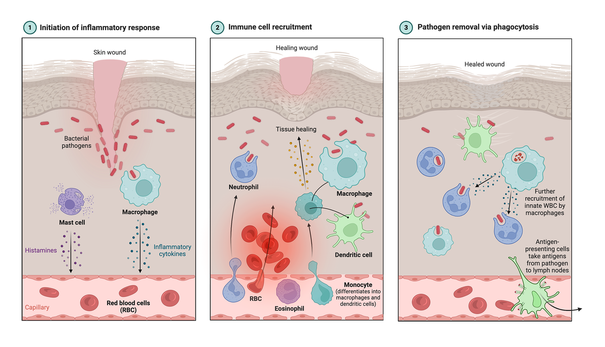 Biology 7.4.1 General inflammation response using bacterial example ...